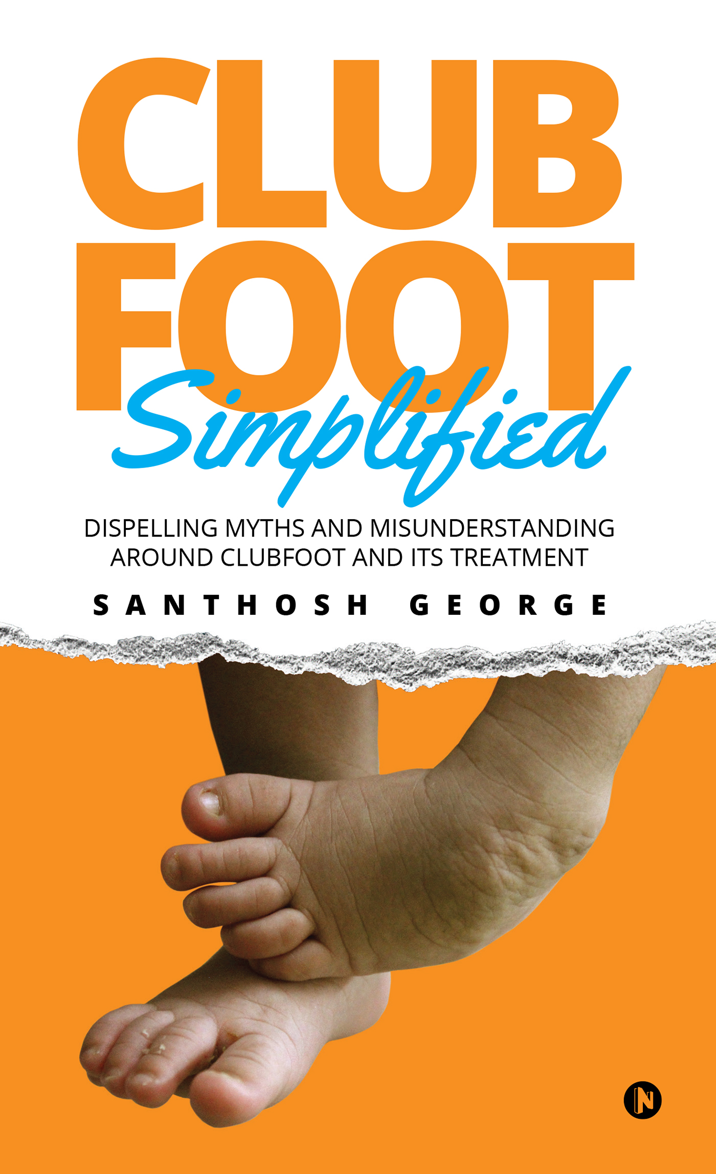 Buy Clubfoot Simplified Dispelling Myths and Misunderstanding around ...