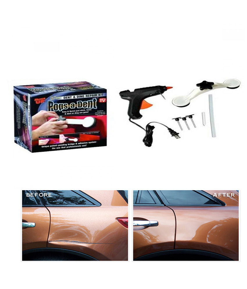 Buy Dent King (Set of 1) Online @ ₹429 from ShopClues