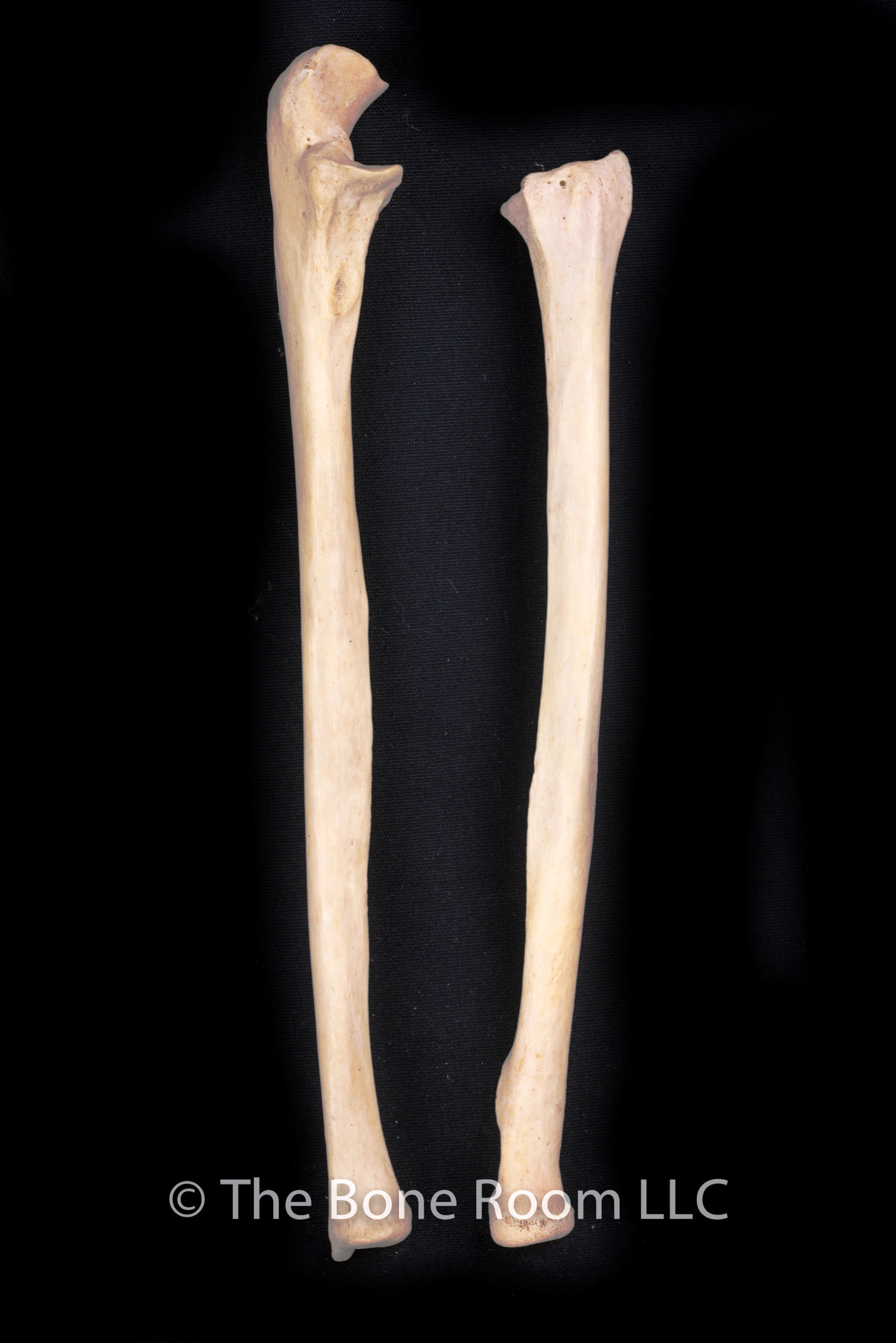 Buy Human Radius Ulna Bone Left Skeleton Anatomy Model by Prototype ...