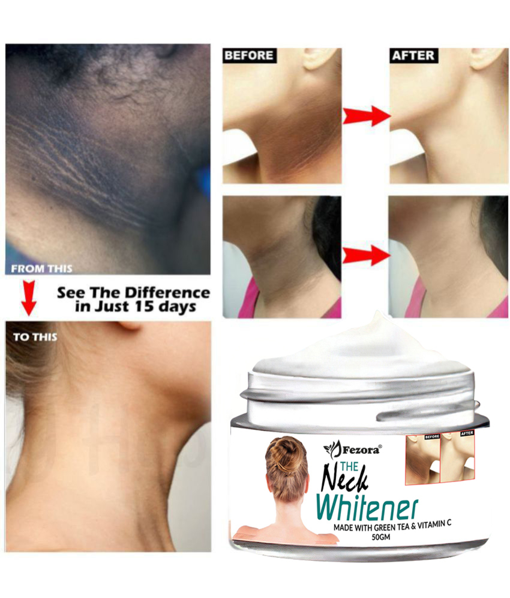 Buy Whitening Lightening Cream for Removal of Hyperpigmentation For ...
